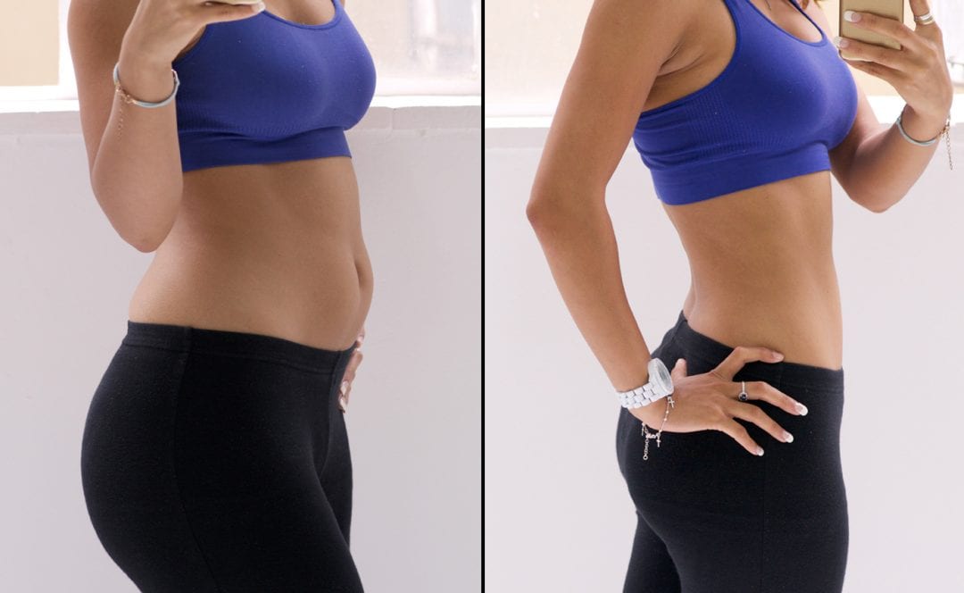 Slimwave - Institut Derma Cellulite